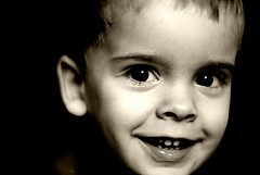 Treating a Unilateral Lisp - Marshalla Speech & Language