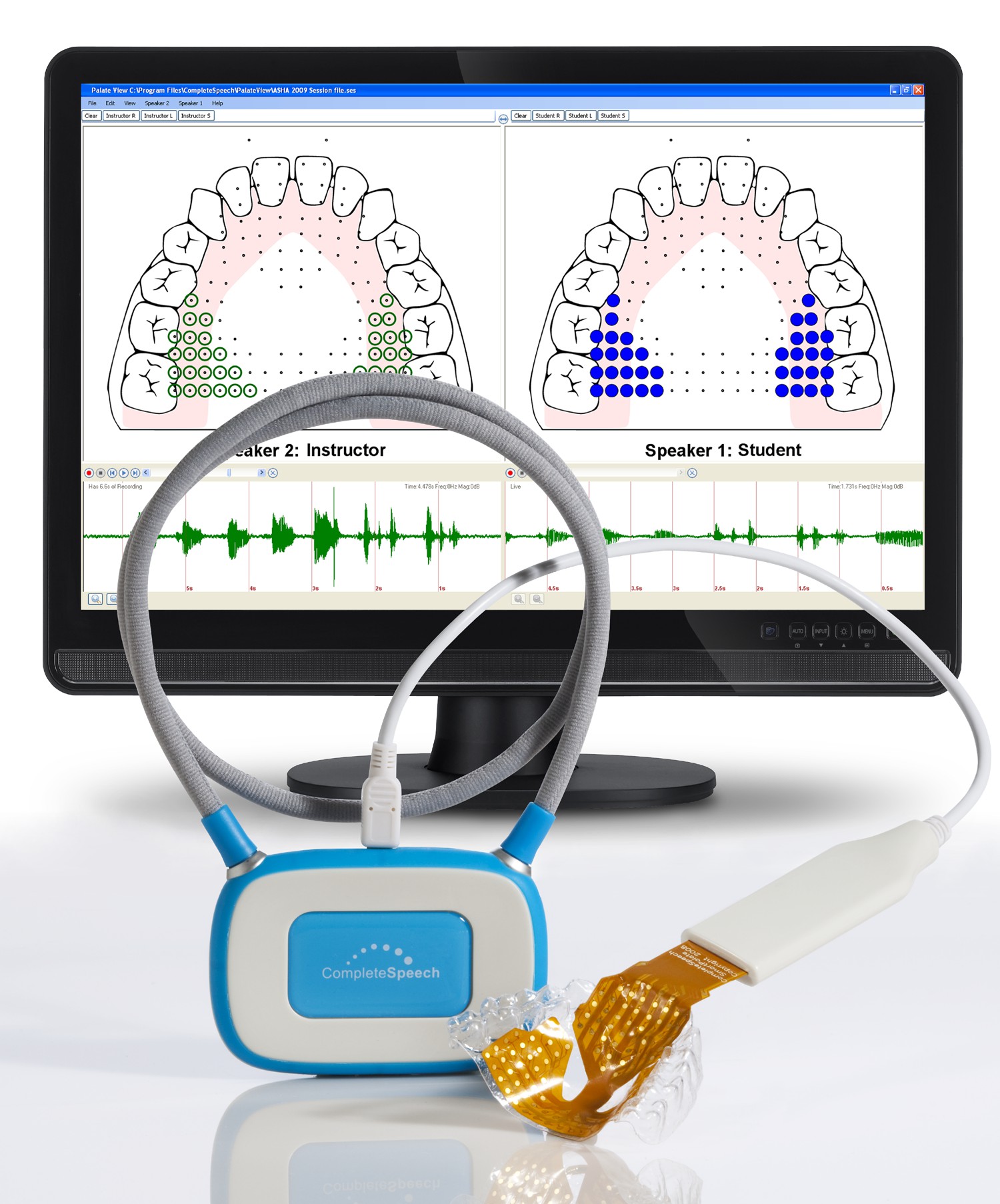 SmartPalate - Marshalla Speech & Language