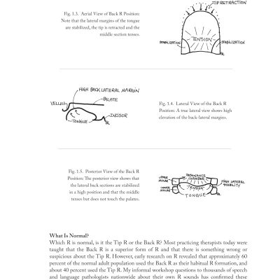 Successful R Therapy: Fixing the Hardest Sound in the World - Marshalla ...